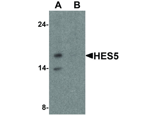 HES5 Antibody (600-401-BR0) | Rockland