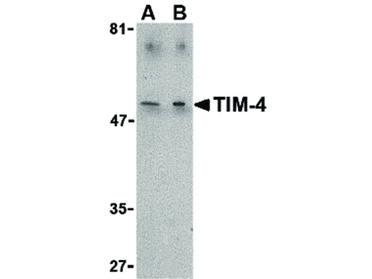 TIM-4 Antibody (600-401-FE8) | Rockland