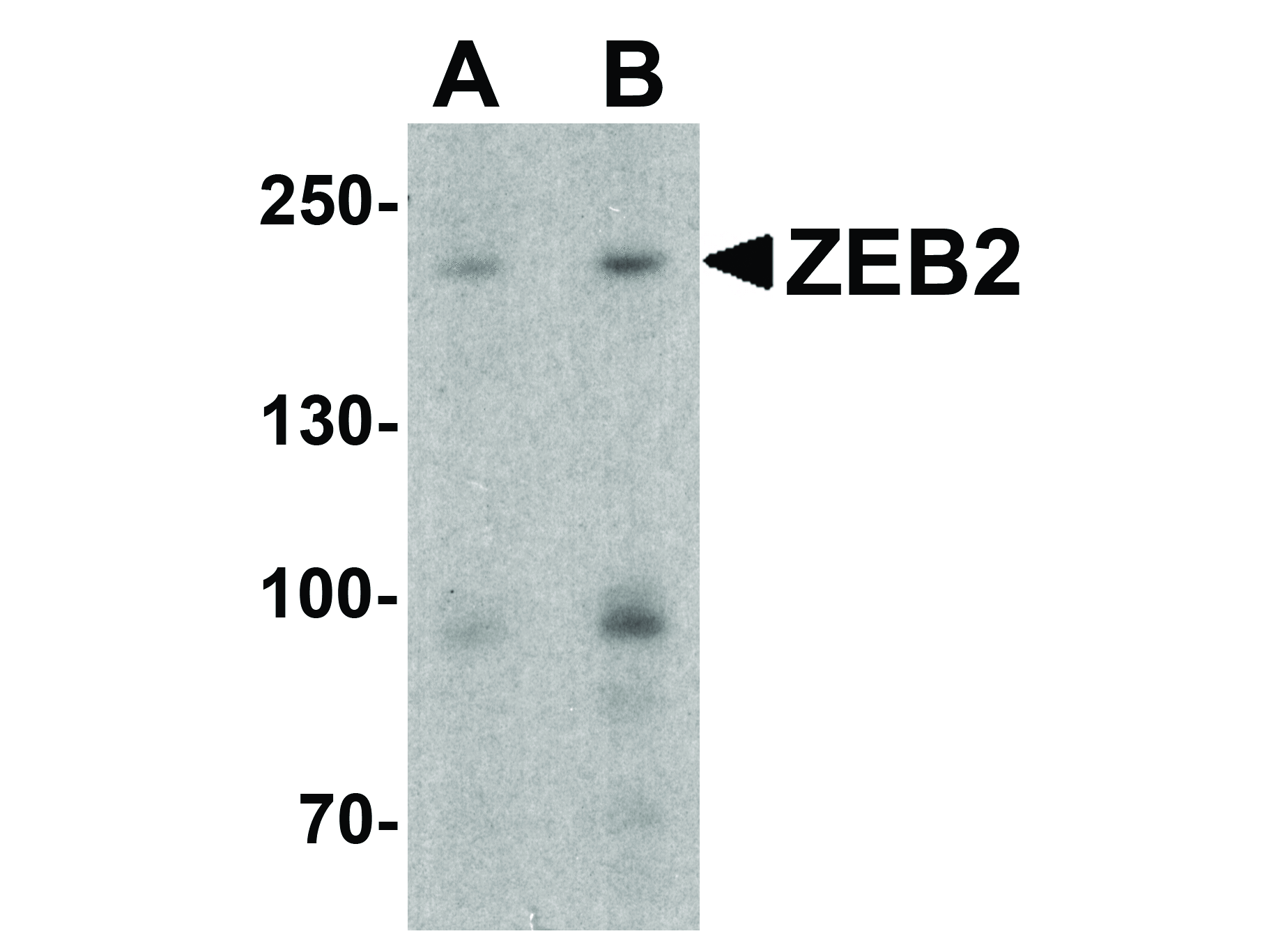 ZEB2 Antibody (600-401-GD1) | Rockland